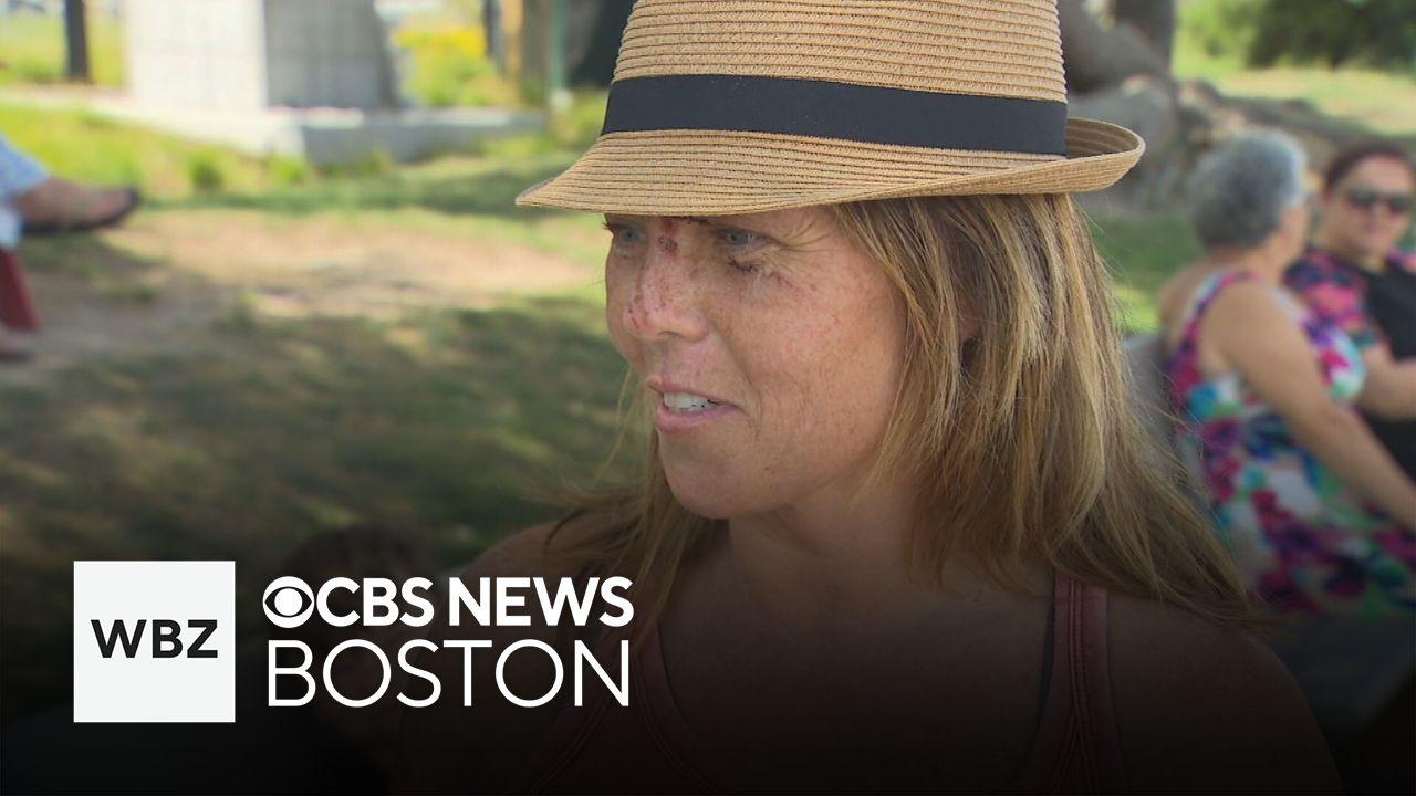 Large leaping fish hits woman in the face in Massachusetts river, "She ...