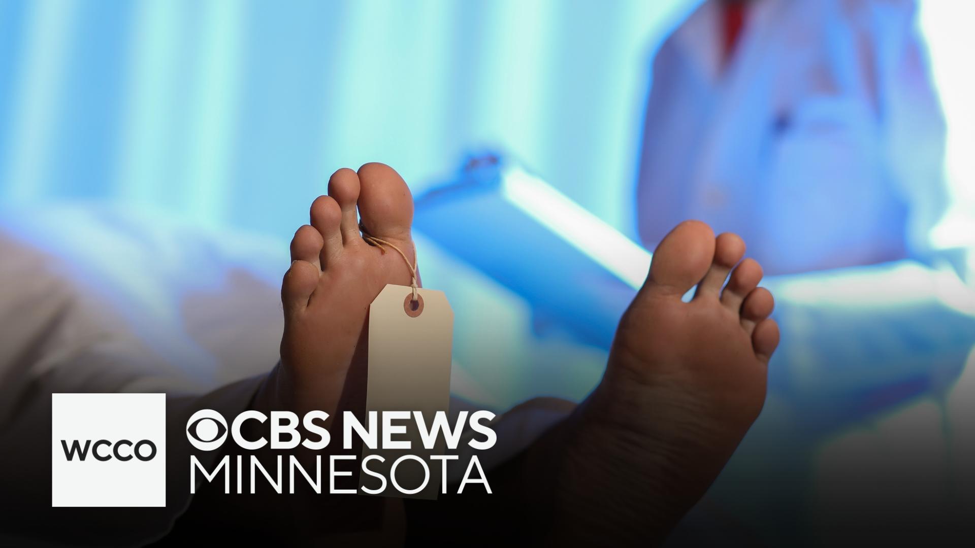 7 autopsies performed by embattled ex-Ramsey County medical examiner to ... 7 autopsies performed by embattled ex-Ramsey County medical examiner to ...