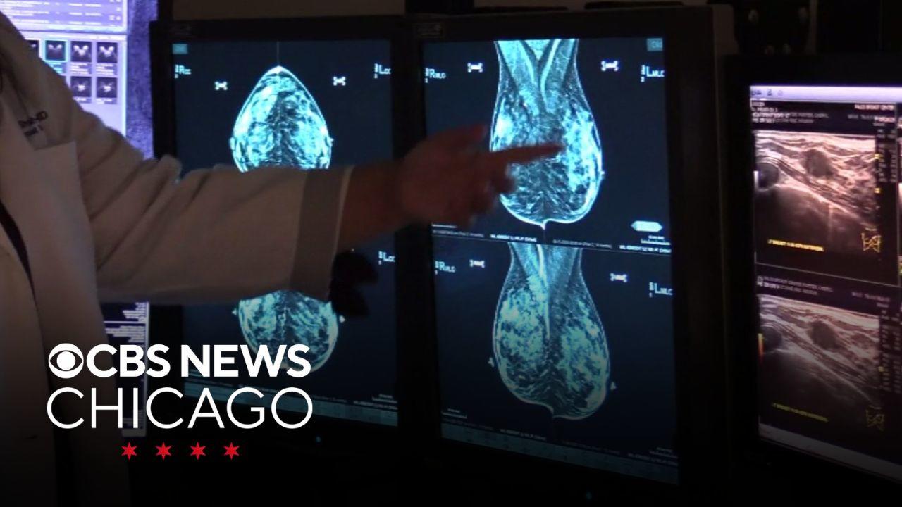 Cancer survivors urge women to learn about breast density and impact on ...