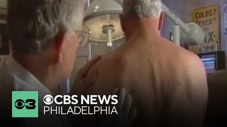 Former eye surgeon tests new way to treat shingles of the eye for a ...