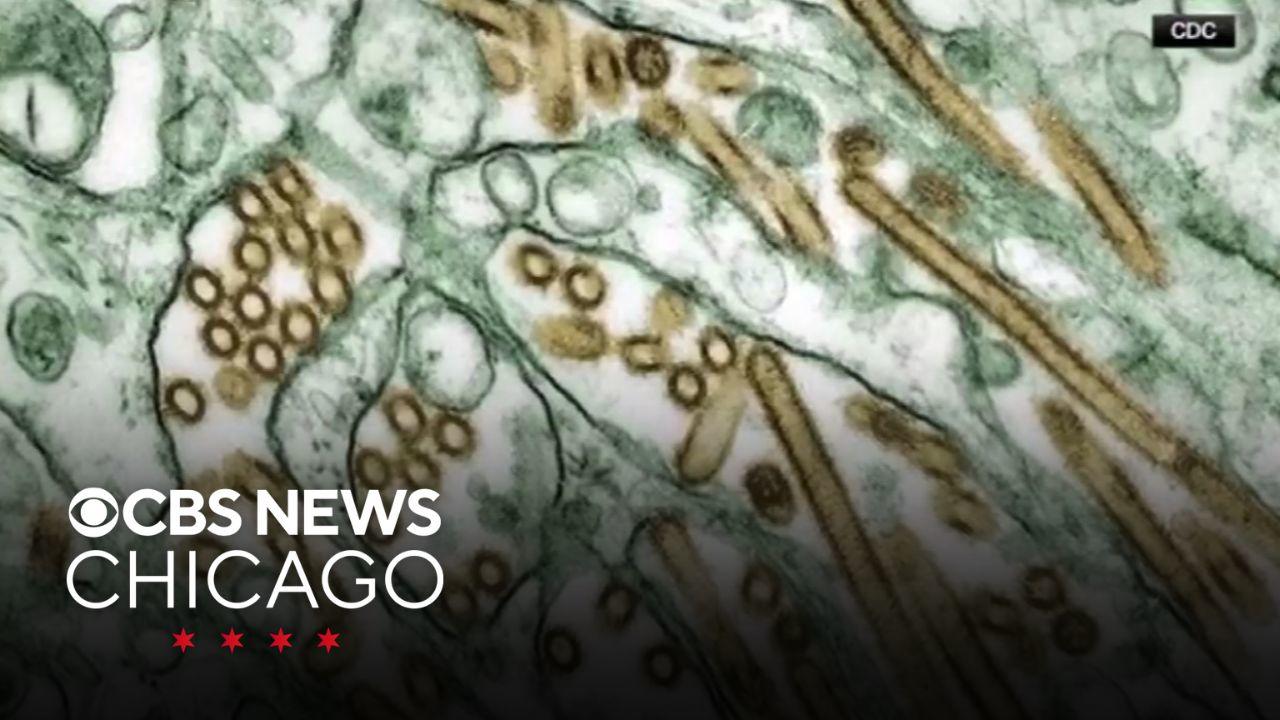 Wisconsin reports its first human case of bird flu - CBS Chicago
