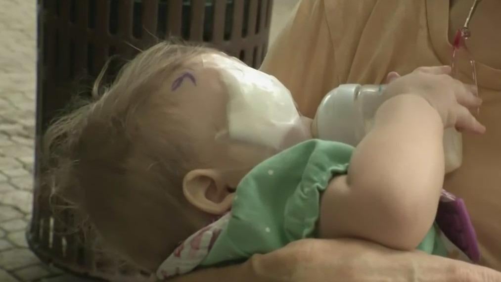 Romanian orphan receives life-changing surgery at Miami's Bascom Palmer ...