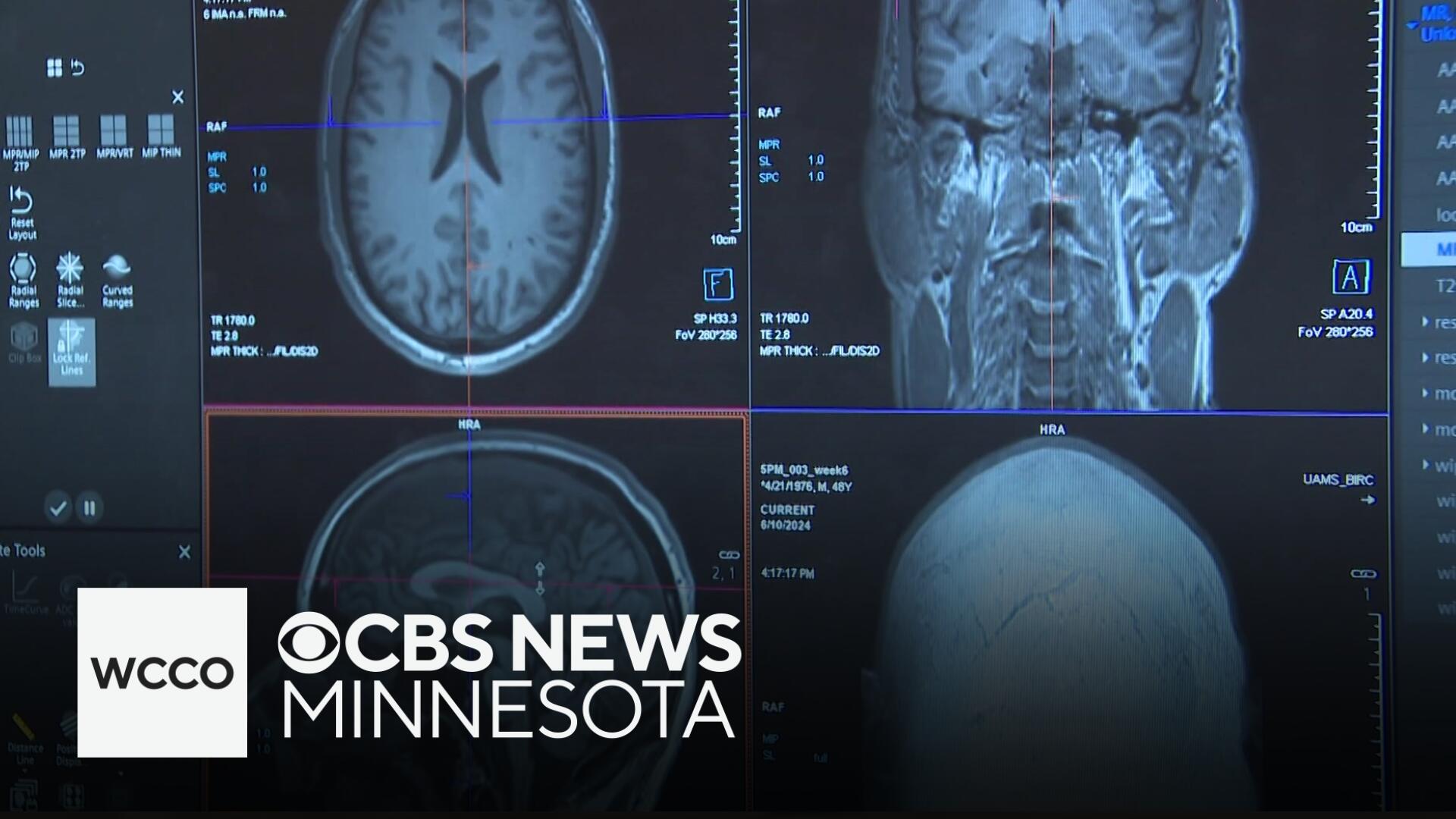 The feeling of boredom serves a purpose, expert says. Here's why. - CBS ...