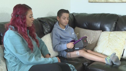 Colorado boy undergoes limb-lengthening surgery after his father tried ...