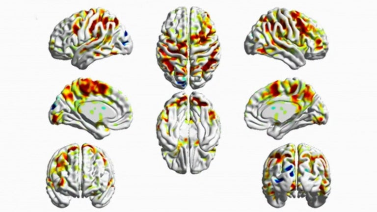 Smartphone addiction is leading to "brain rot," doctors say - CBS News