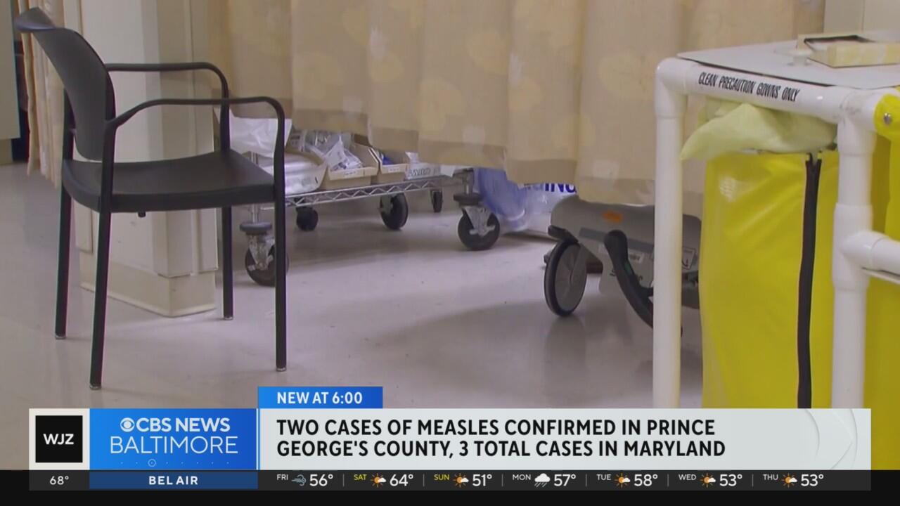 2 more Maryland measles cases confirmed from international travelers - CBS Baltimore