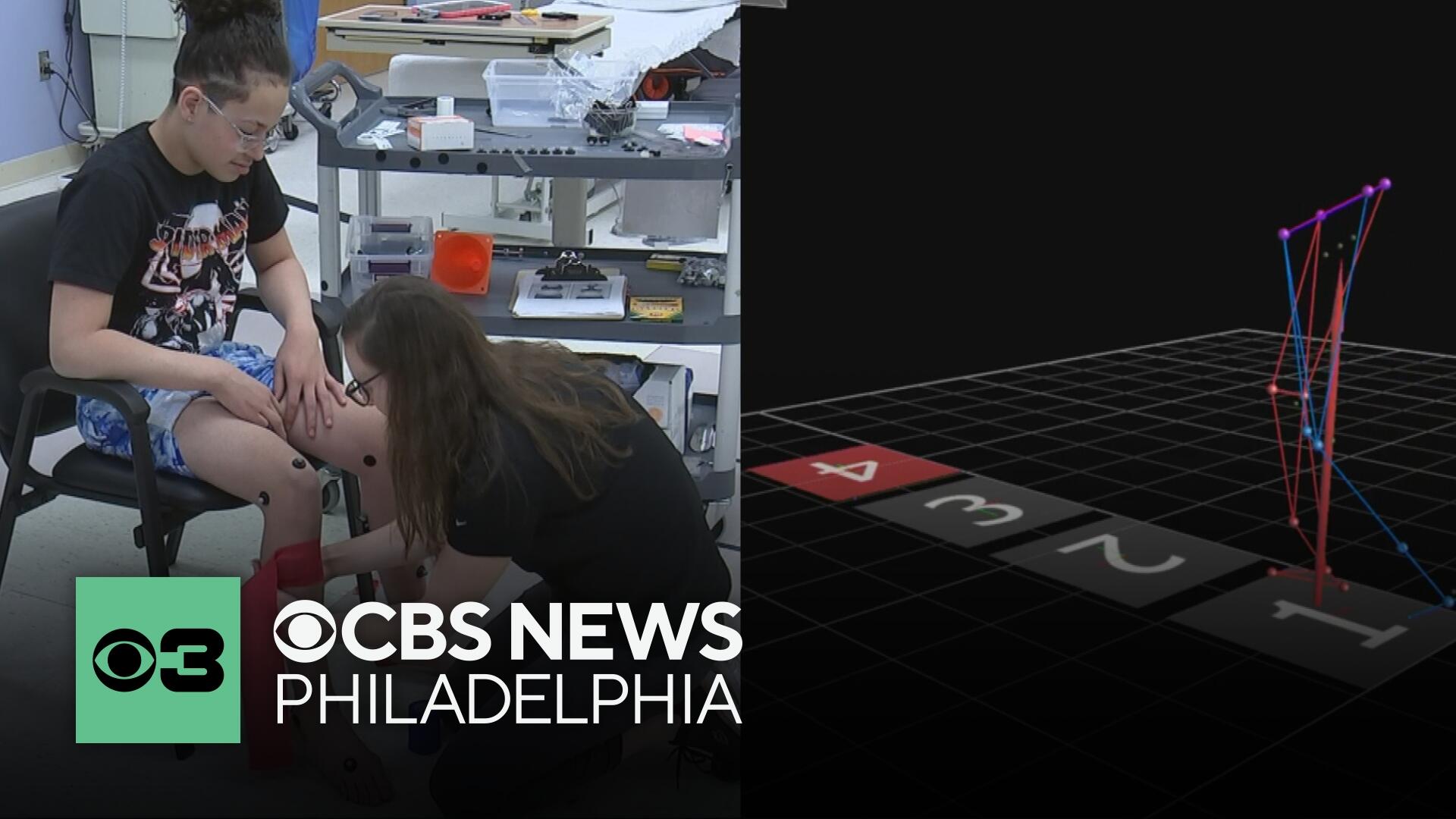 Shriners Children's Philadelphia has a newly integrated motion analysis ...