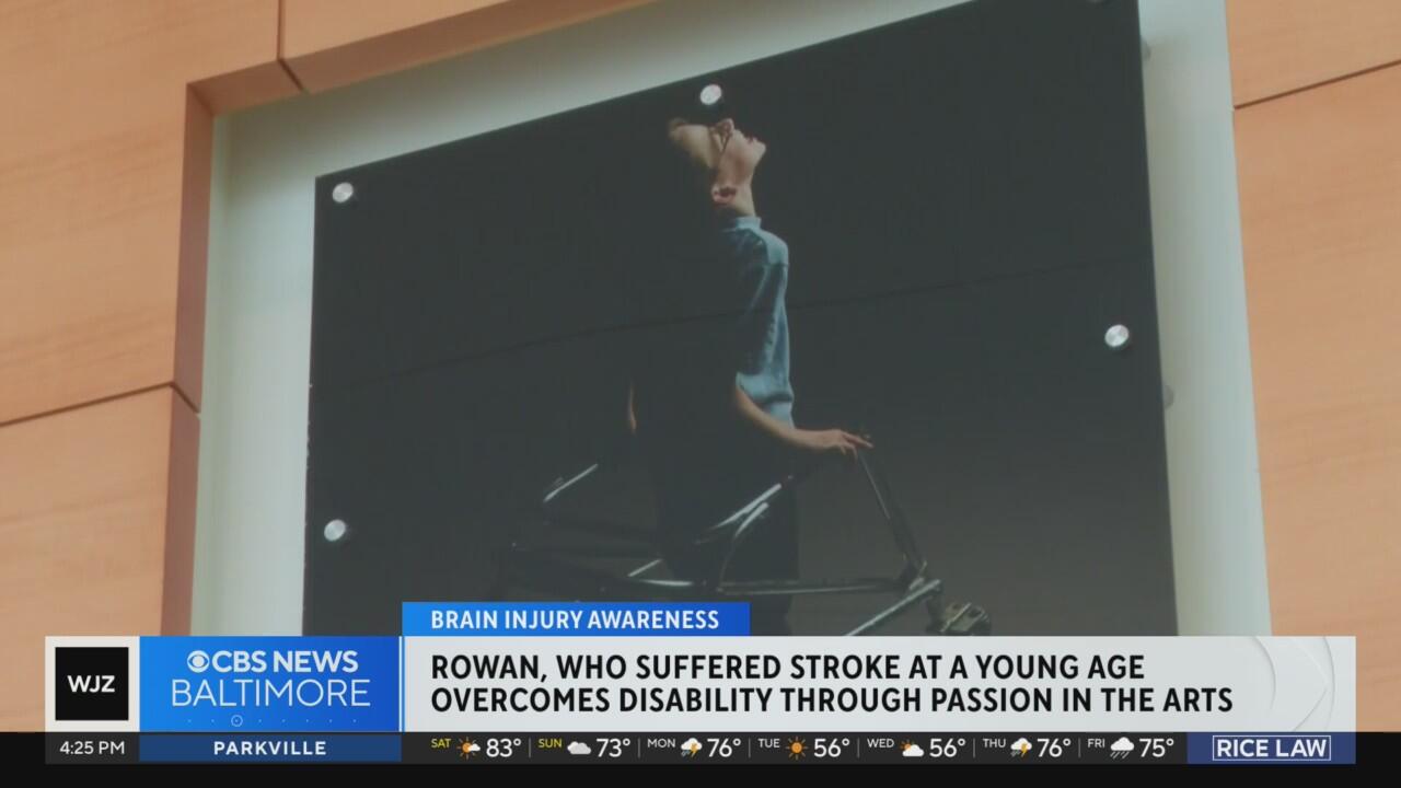 Young Stroke Survivor Finds Passion In Theater Despite Disability Cbs