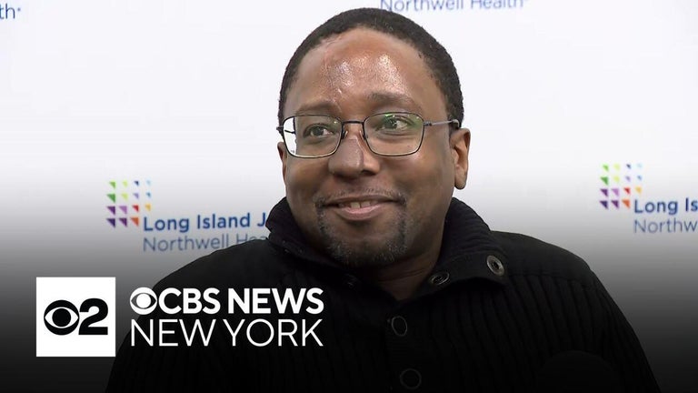 Long Island man whose nose was bitten off sees incredible ...