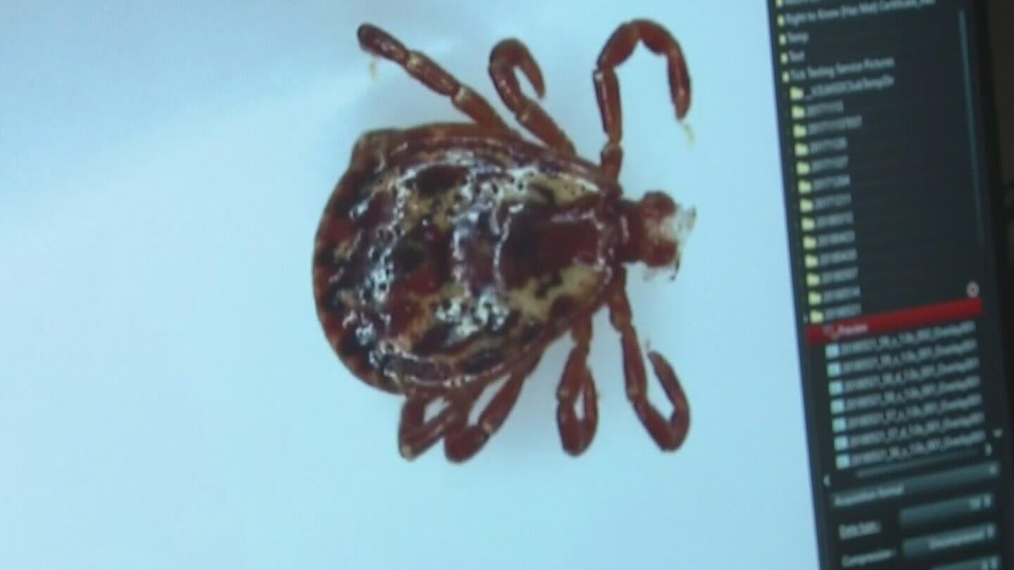 California is seeing spike in tick-borne illness anaplasmosis, experts ...