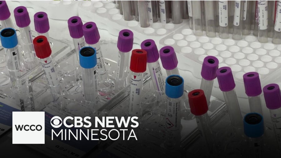 Blood donation appointments up 400% since Annunciation mass shooting ...