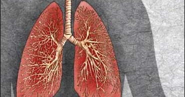 Whooping Cough Makes Comeback - CBS News