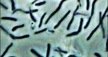 Back To School, Back To Germs - CBS News