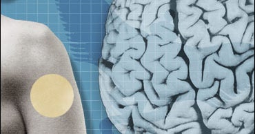 FDA Approves Skin Patch For Alzheimer's - CBS News