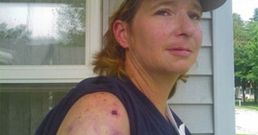 Kathy Myers Shot Herself to Get Medical Care - CBS News