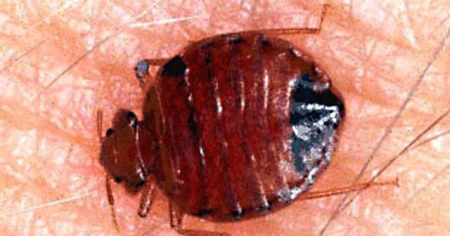 Bed Bug Lingerie Infestation: Really Gross, but Health Hazard? - CBS News