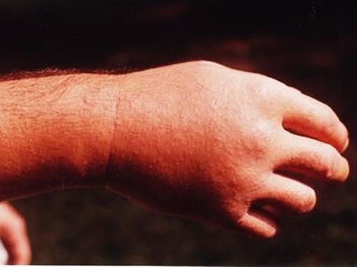 10 Most Terrifying Parasites Ever