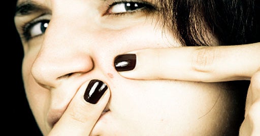 Acne-ADHD link? - CBS News