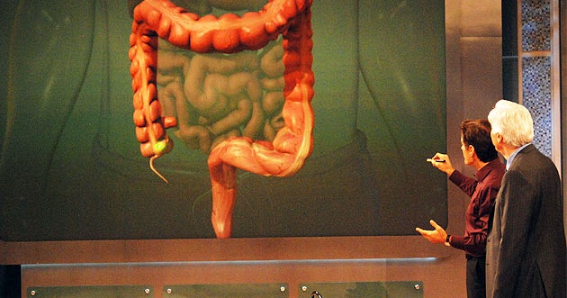 Dr. Oz's Colonoscopy Finds Pre-Cancerous Polyp: What Can He Teach Us ...