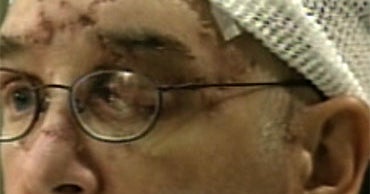 Bear Attack Victim Recounts How He Survived - CBS News