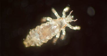 Lice DNA Point to First Humans' Use of Clothing - CBS News