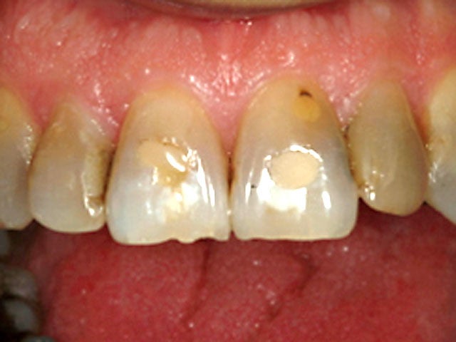 Foul mouth: what yucky signs say about your health