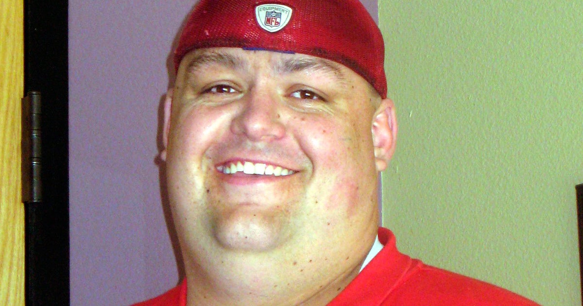 "Heart Attack Grill" spokesman dies at 29 - CBS News