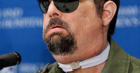 Dallas Wiens' amazing new face