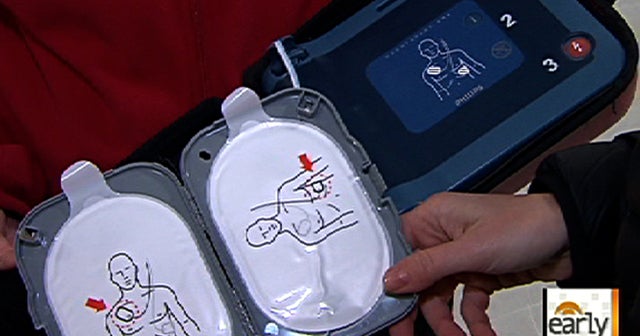 Early AED use saves young athletes' lives - CBS News