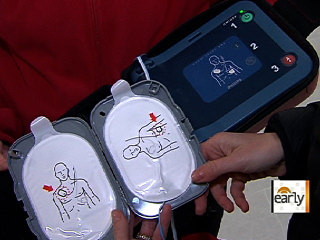 Defibrillators becoming de rigeur for police - CBS News
