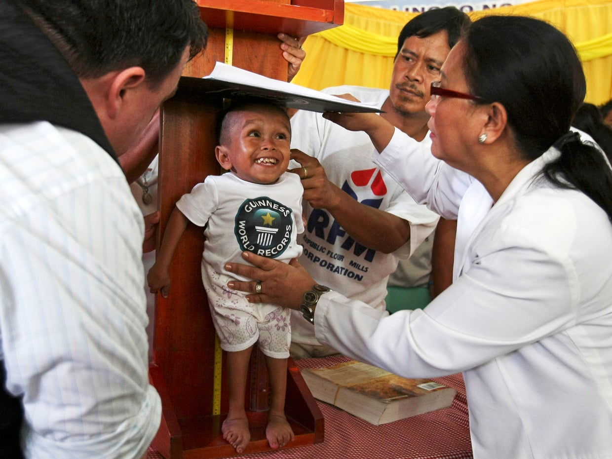 Meet world's shortest man, Junrey Balawing