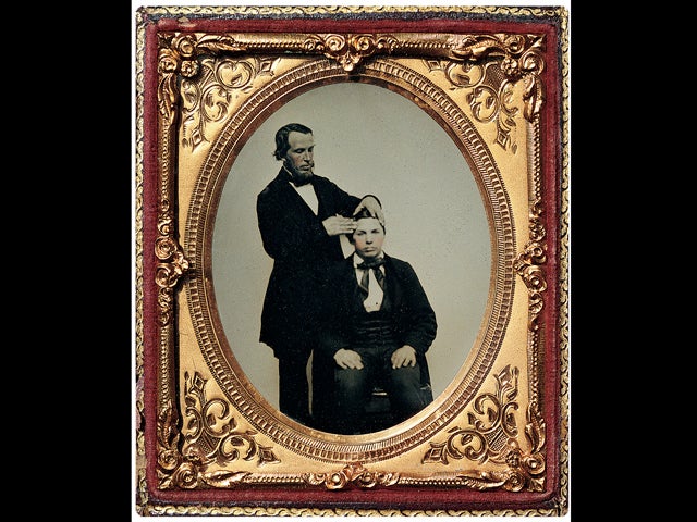 19th and 20th century psychiatry: 22 rare photos 19th and 20th century psychiatry: 22 rare photos