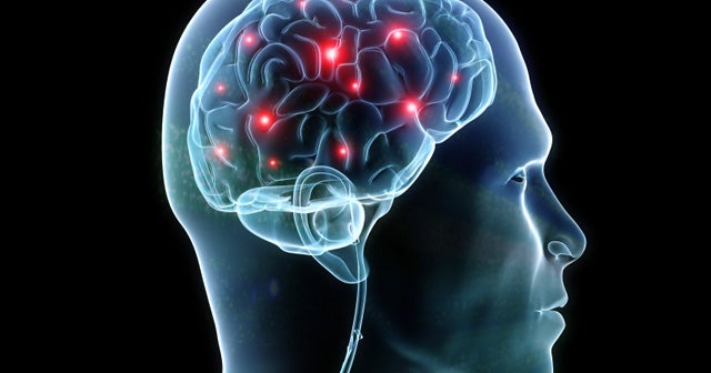 Head's up: Brains found to survive decapitation - CBS News