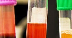 Depression blood test for teens may lead to better treatment, less ...