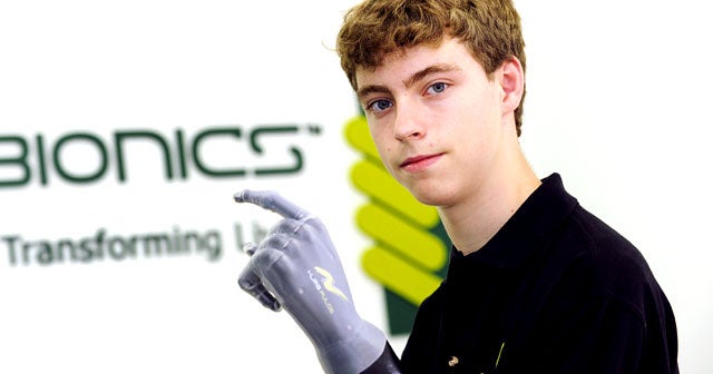 Teen F1 fan gets bionic hand with help of Mercedes team - CBS News