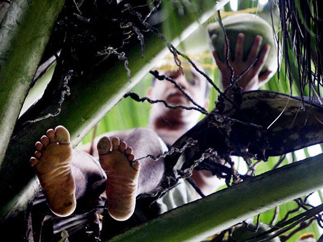 Man with 12 fingers, 12 toes vs. boy with 34 digits