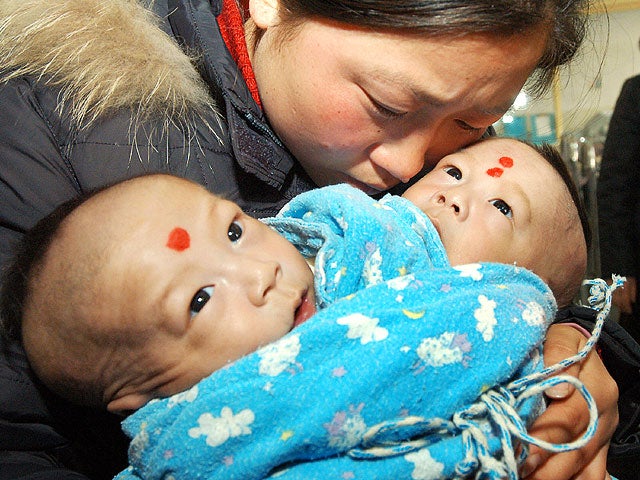 Conjoined twins (WARNING: GRAPHIC IMAGES)