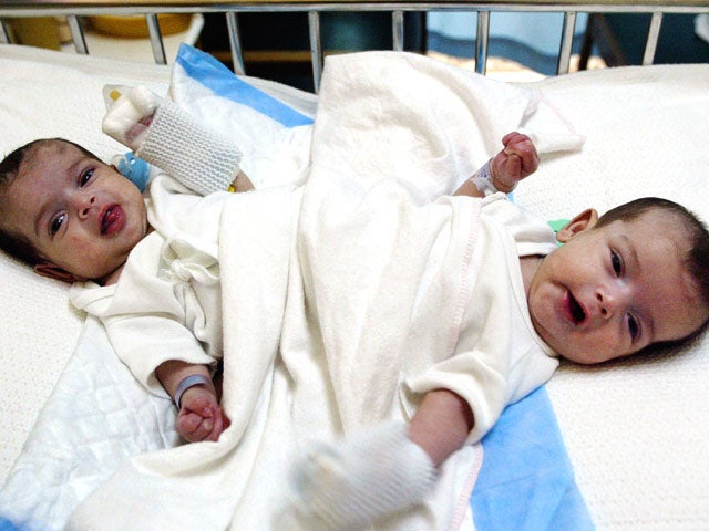 Abby And Brittany Hensel Baby