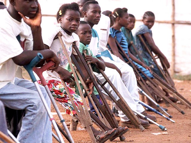 Poliomyelitis: 24 photos of crippling disease