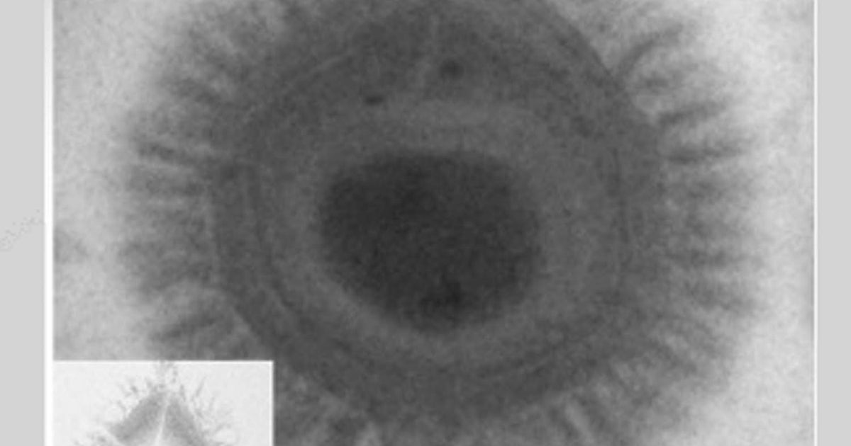 Gigantic virus discovery rivets scientists - CBS News