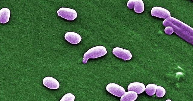 Anthrax vaccine tests in children not expected soon - CBS News