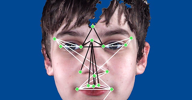 Children with autism have distinct facial features: Study - CBS News