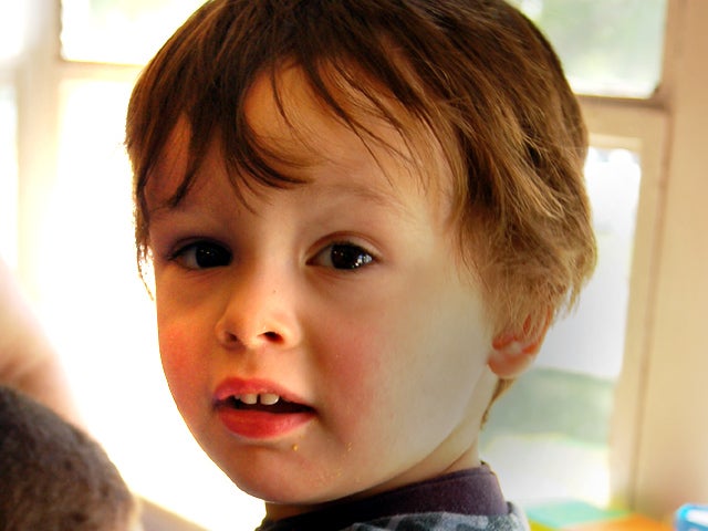 Is it autism? Facial features that show disorder