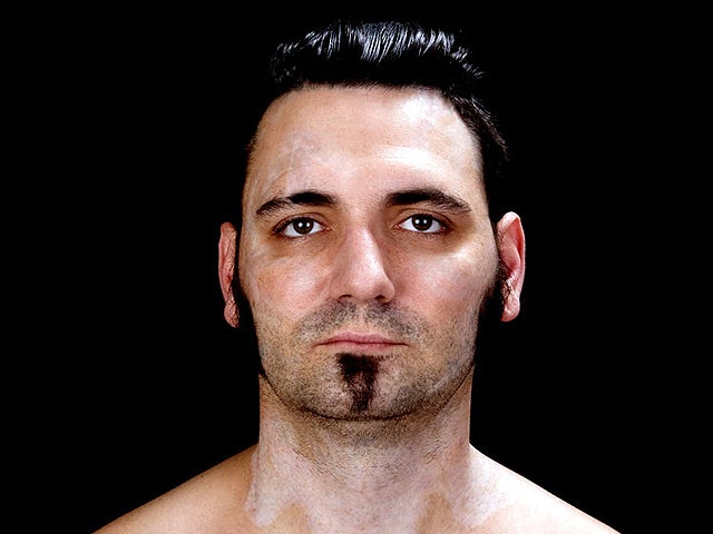 Nazi skinhead sheds tattoos: 16 amazing photos