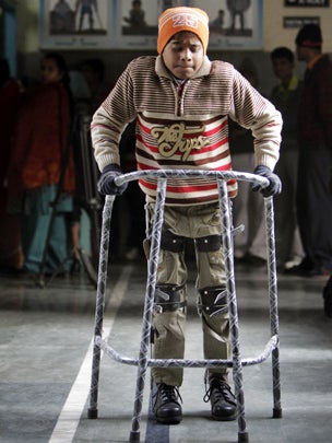 Poliomyelitis: 24 photos of crippling disease