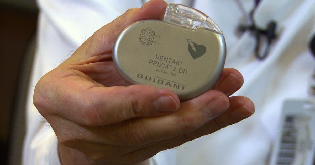 When medical implants fail - CBS News