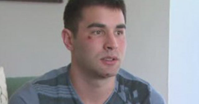 Gay Illinois State student claims attack was a hate crime - CBS News