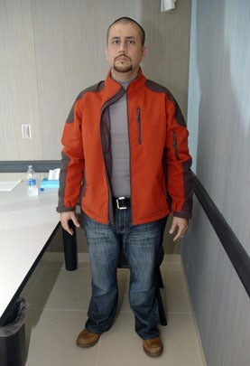 George Zimmerman's injuries