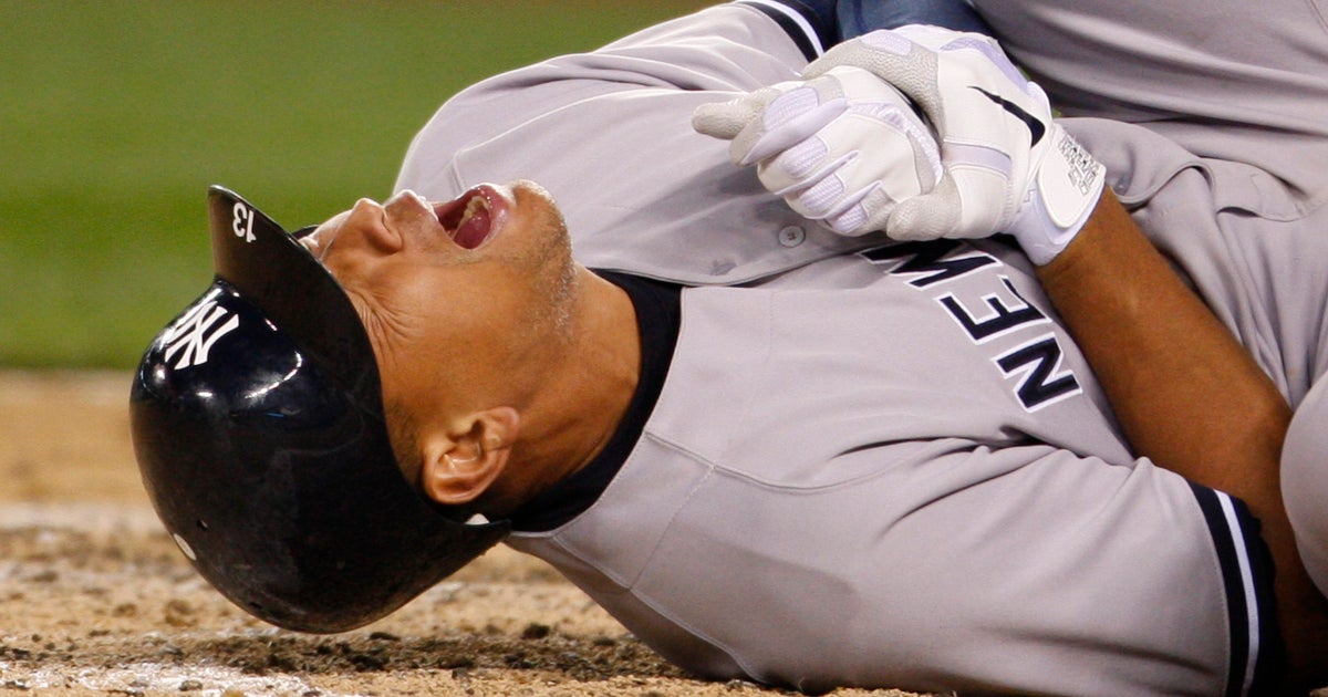 Alex Rodriguez breaks hand in Yankees' loss - CBS News