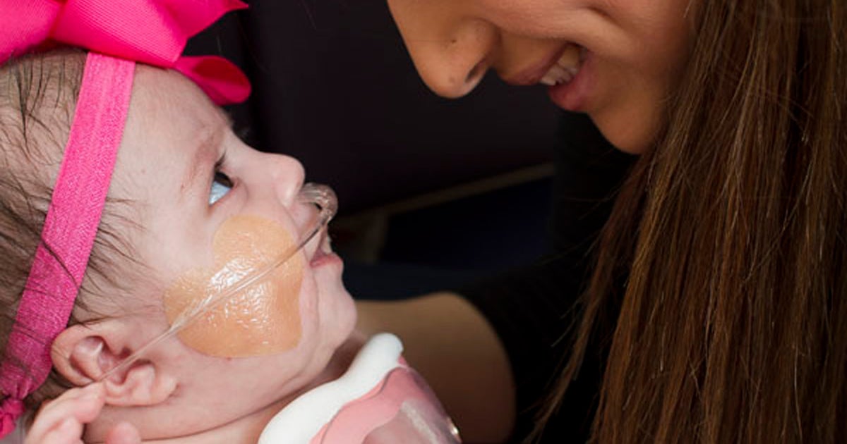 Baby born with heart outside body leaves hospital - CBS News